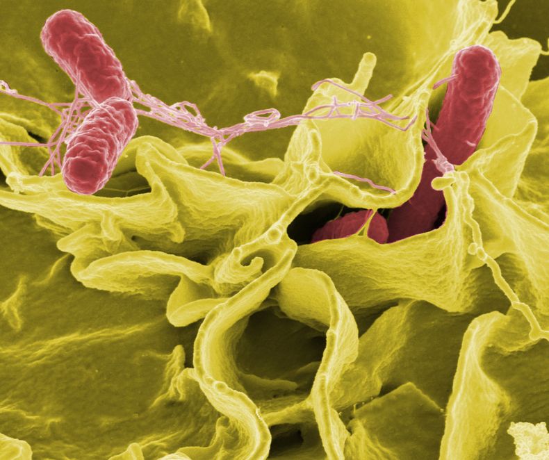 Salud Estas Son Las Superbacterias Más Letales